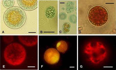 Upper Row Bright Field Micrographs Of Palmelloid Cells A A Motile