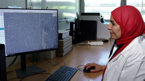 Image Analysis To Obtain Prognostic Information For Tumor Infiltrating