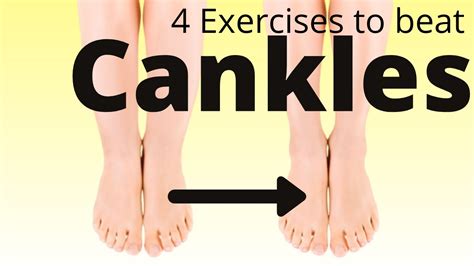 Cankles Vs Ankles