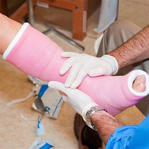 Can Physical Therapy Help After A Broken Bone