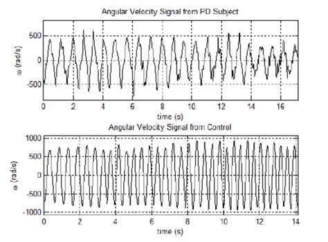 Comparison Of Angular Velocity Signals From A Pd Subject Top And