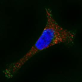 Human Alpha Galactosidase A Gla Antibody Af6146 Randd Systems