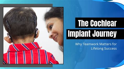 Cochlear Implant Switch On And Mapping Process Explained Sphear Clinics