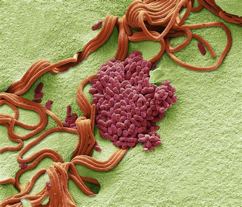 Bacteria From A Water Butt Sem Stock Image C0371248 Science