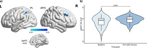 Pgacc Resting State Functional Connectivity And Glutamate Levels 24 H Download Scientific