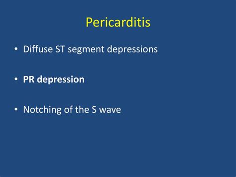 Ppt Ecgs Powerpoint Presentation Free Download Id 3701177
