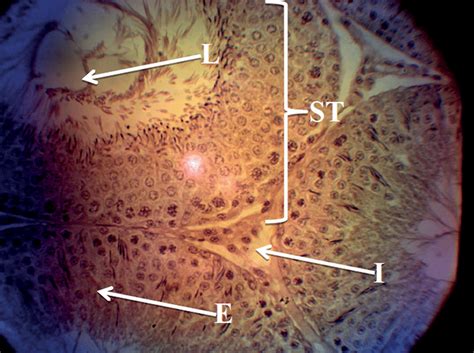Histology Of The Testis Of The Control Group Showing Normal Testicular