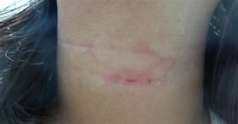 Something In My Neck Album On Imgur