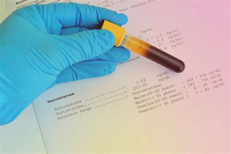Decoding Testosterone Reference Ranges Your Health Beyond The Average