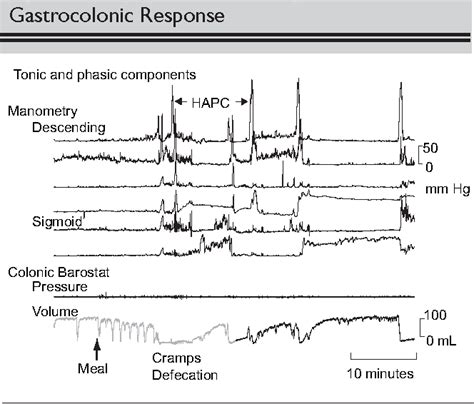 Figure 1 From Pathophysiology Of Chronic Constipation And Ibs Semantic Scholar