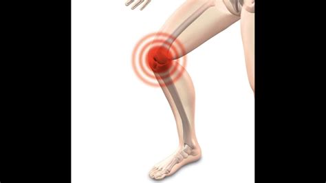 Osteoarthritis Heres How Stem Cell Therapy Works As Pain Relief To