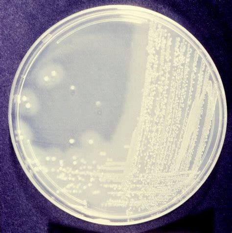 Free Picture Gelatin Agar Identification Bacteria Vibrio Cholerae