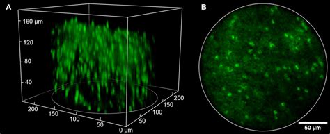 Frontiers Advances Of Optical Miniscopes For In Vivo Imaging Of