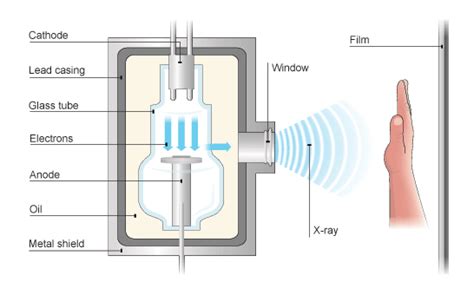 Cancer Therapy Describe How Gamma Rays Are Used In Cancer Therapy