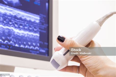 여자 의사 손 배경 화면 초음파 기계에 초음파 프로브를 잡고 하 고 환자에 대 한 초음파 연구에 대 한 준비 의학 및 의료