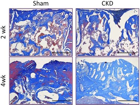 Delayed Collagen Maturation In Ckd Rats Masson Trichrome Staining Of