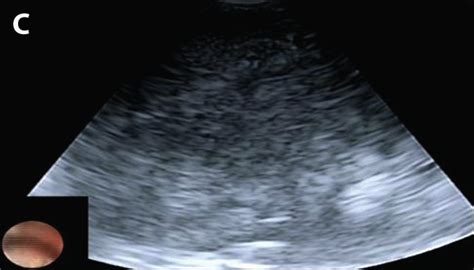 Lymph Node Pattern A Normal Triangular Lymph Node With A Conserved Download Scientific