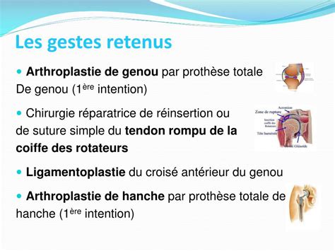 PPT La procédure de MSAP Retour dexpérience PowerPoint Presentation