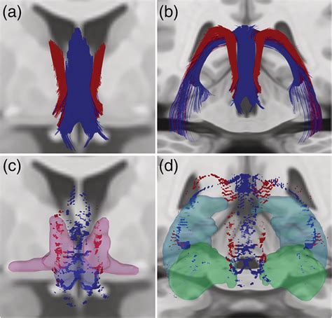 Fornix And Stria Terminalis Human Connectome Project Group