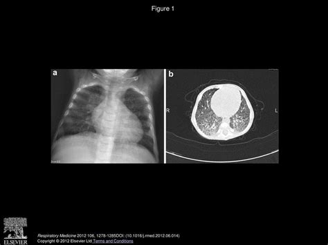 Volume 106 Issue 9 Pages September 2012 Ppt Indir