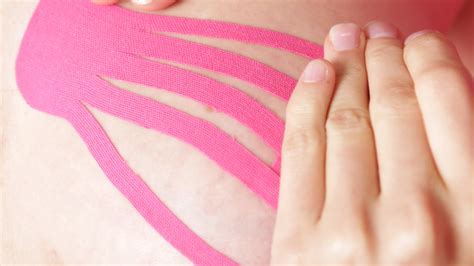 Taping No Pós Operatório O Que Você Precisa Saber Clínica Lindomar