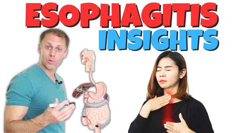 Improving Esophageal Inflammation Esophagitis Youtube