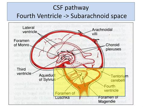 2016 03 16 Csf Pathway Abnormalities Pptx Brain And Nervous System Disorders Diseases And