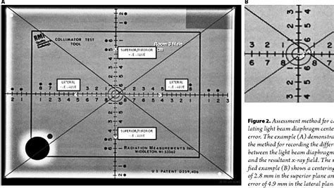 Figure From Light Beam Diaphragm Collimation Errors And Their Effects On Radiation Dose For