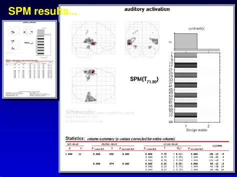 PPT Parametric Thresholding Methods Random Field Theory False Discovery Rate PowerPoint