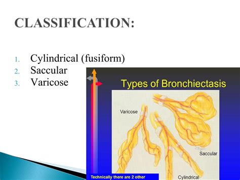 Bronchiectases Ppt