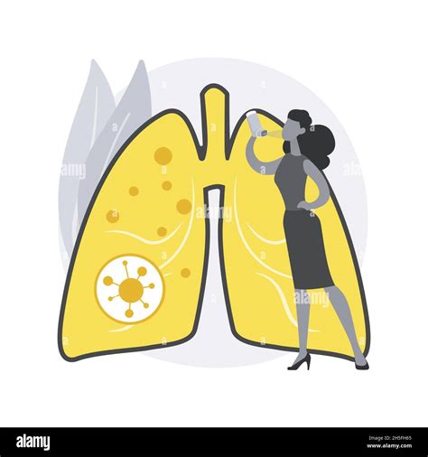 Anaphylaxis Abstract Concept Vector Illustration Stock Vector Image