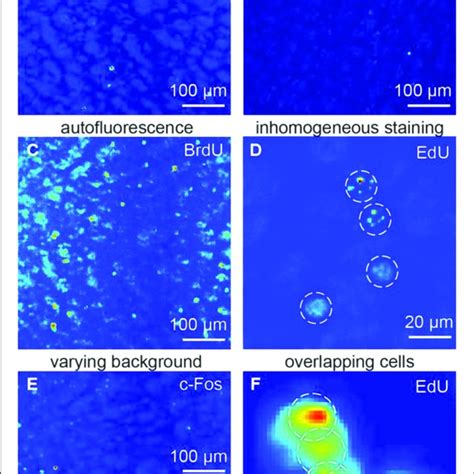 Challenges For The Automatic Algorithms Of Cell Detection A B