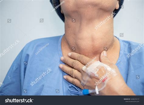 Enlarged Multinodular Thyroid Goiter Middleaged Asian Photo De Stock