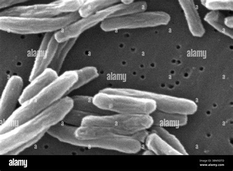 File This 2006 Electron Microscope Image Provided By The Centers For