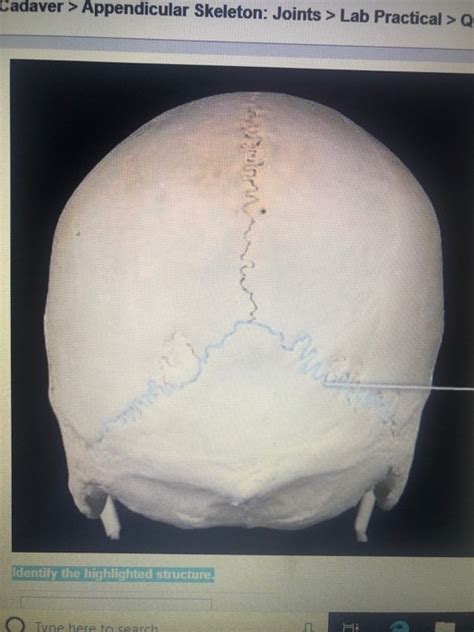 Solved Cadaver Appendicular Skeleton Joints Lab Chegg