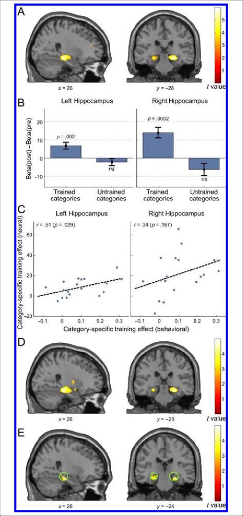 Neural Correlates Of Perceptual Training Whole Brain T Maps Are Download Scientific Diagram