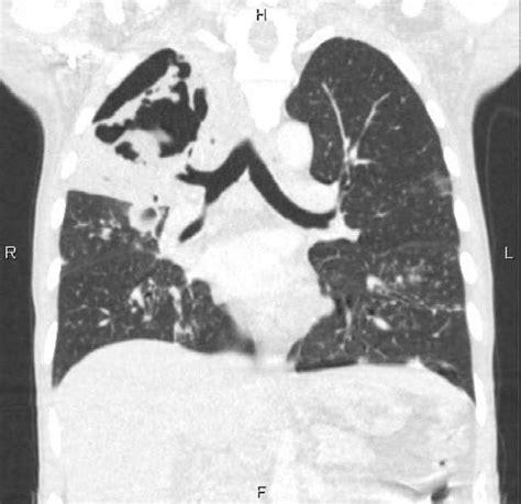 Journal Of Brown Hospital Medicine On Twitter A 35 Year Old Man In