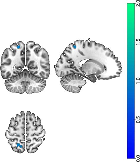 Results Of The Contrast Analysis Between Arrow And Gaze Cueing Download Scientific Diagram