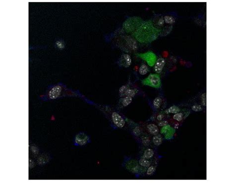 Hyperspectral Image Cell Segmentation And Tracking Anry In The Last