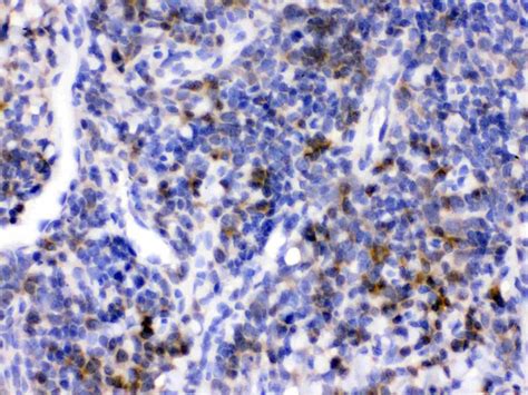 Cd33 Antibody Pa5 78977