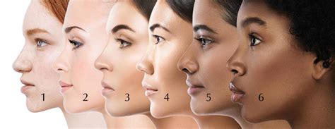 Fitzpatrick Scale Bare Laser Medspa