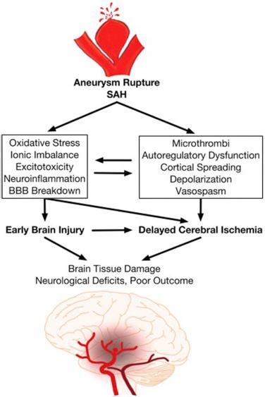Pathophysiology Of Subarachnoid Hemorrhage Early Brain Injury And