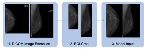 Using Retrieval Augmented Generation Rag On A Custom Pdf Dataset With