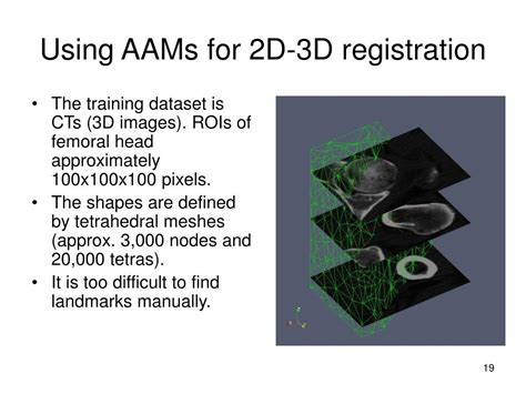 Ppt Intensity Based Deformable Registration Of 2d Fluoroscopic X Ray