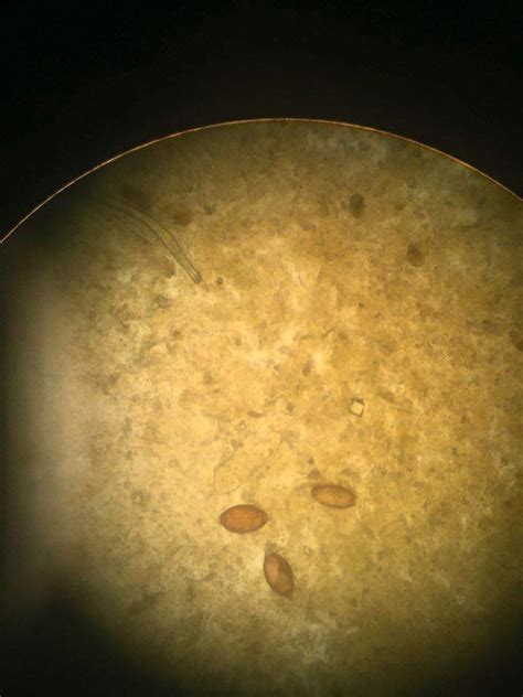 The Whipworm Is One Of The Four Petish Animal Clinic Ii