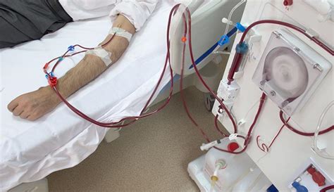 Dialysis Types How It Works Procedure And Side Effects