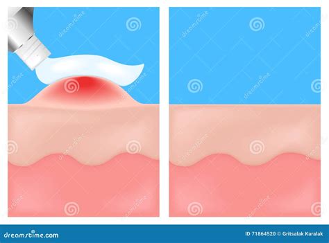 Skin Diseases Derma Infection Eczema And Psoriasis Dermatology