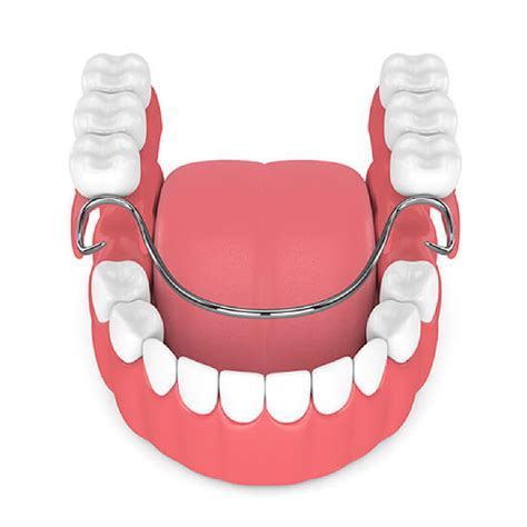 Enhancing Your Smile With Removable Dentures In Magnolia Tx