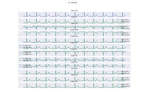 Github Hawkiyc Leads Ecg Reconstruction Wtih U Net Leads Ecg