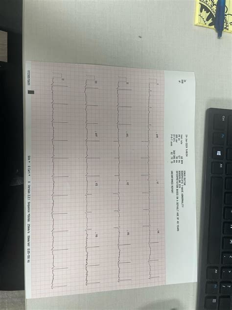 T Wave Abnormality R Readmyecg